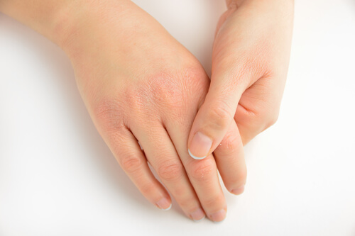 15 Most Common Symptoms of Ringworm - Page 12 of 16